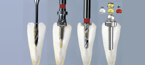 Clix Ball Attachment - Preat Corporation