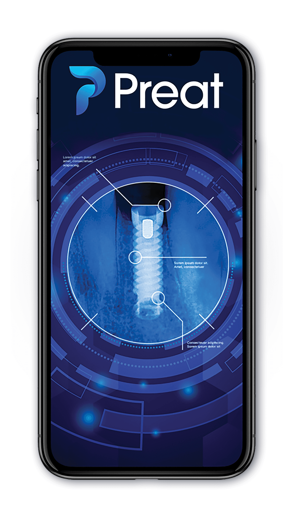 Preat Dental Implant Attachments and Implant Abutments - Preat Corporation