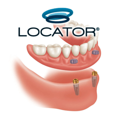 LOCATOR® Self-Aligning - Preat Corporation