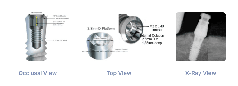 Zimmer® Calcitek®, Centerpulse® & Paragon® - Preat Corporation