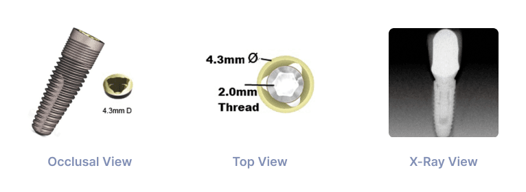 Implant Direct® - Preat Corporation