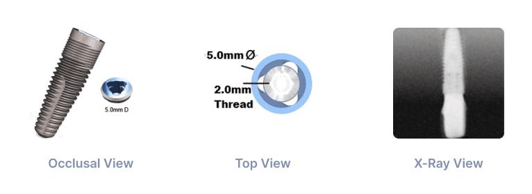 Implant Direct® - Preat Corporation