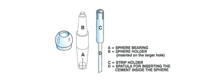 Concave Sphere Reconstruction Kits - Preat Corporation