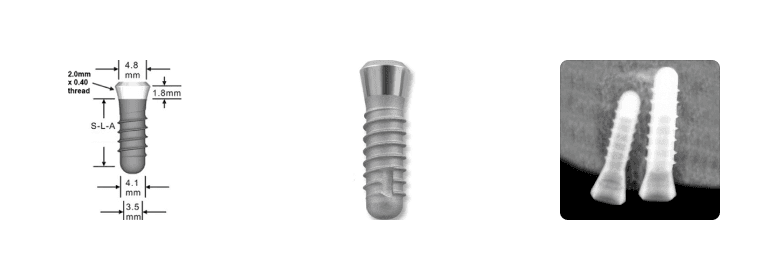 Straumann® – Tissue Level - Preat Corporation