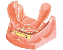 Hader Bar Kits and Components - Preat Corporation