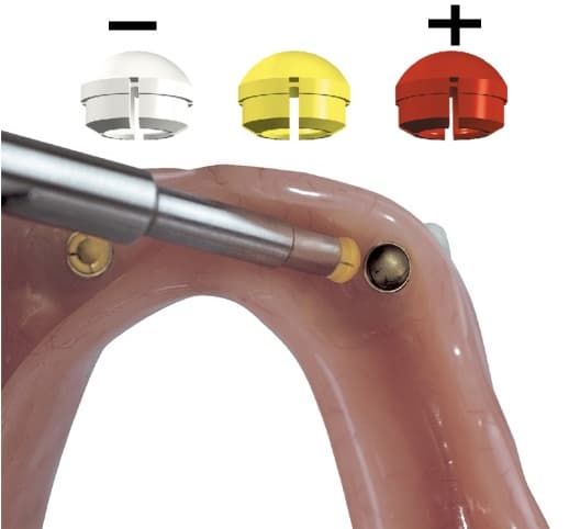 Clix Ball Implant Abutment - Preat Corporation